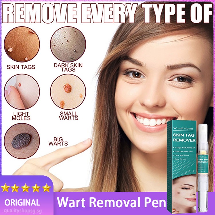 West&Month Wart Removal Liquid Pen Skin Tag Moles Removal Treatment ...