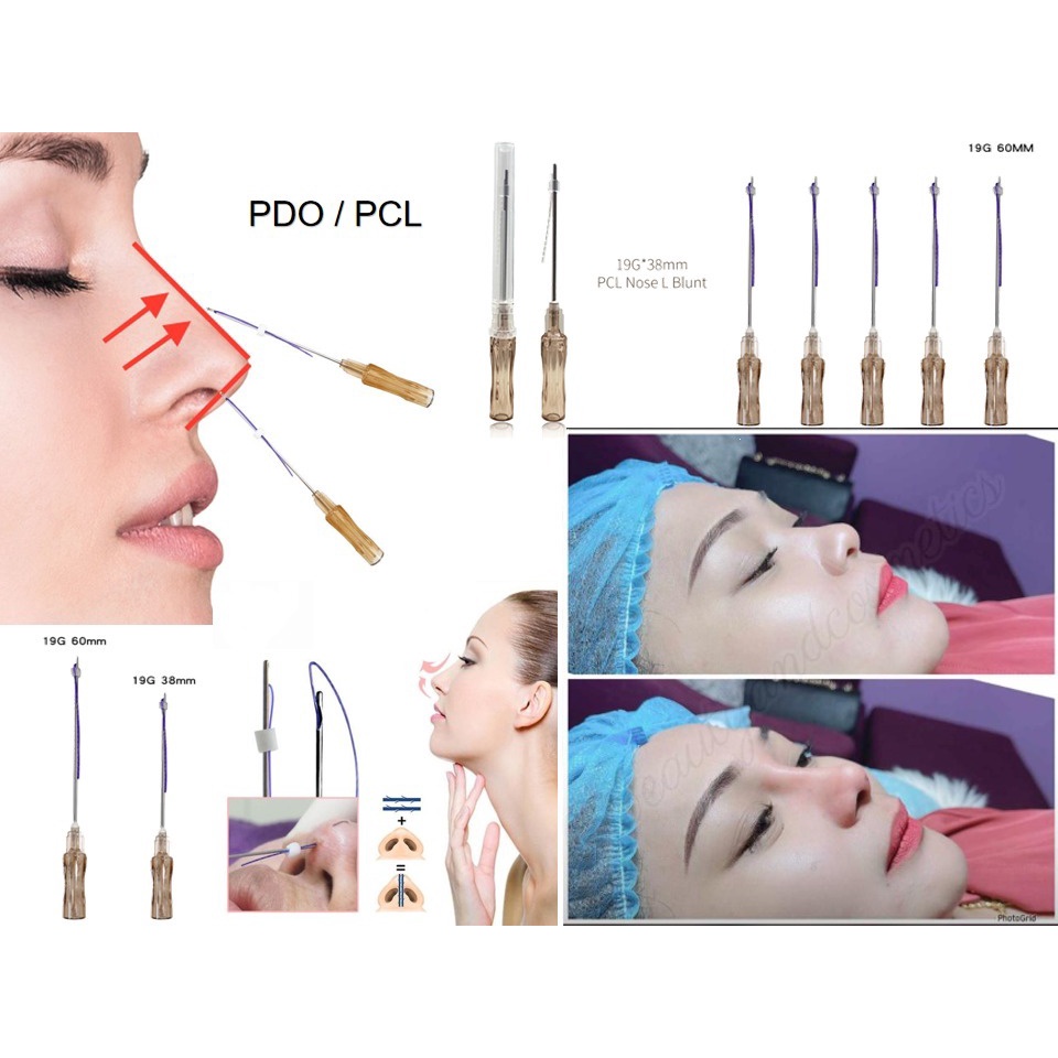 Uverla PDO Nose Thread Cog for Nose Back Lifting 20pcs/Pack | Shopee ...