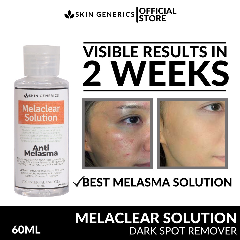 [ #1 MELASMA SOLUTION ] SkinGenerics Anti Melasma Melaclear Solution ...