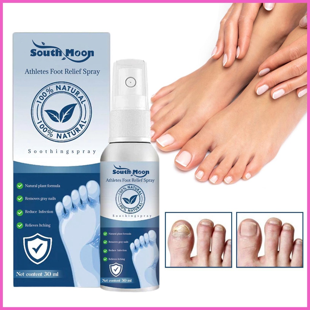 Professional Athletes Foot Spray Natural Anti-Fungi Relief For Inflamed ...