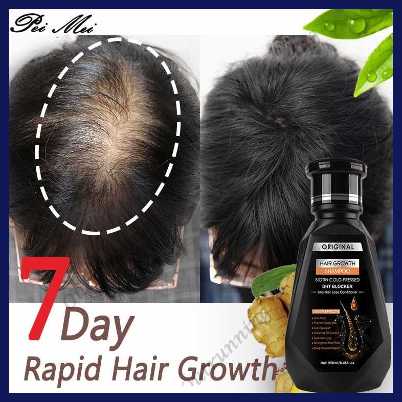 PEIMEI/Cn#ginger[T}shampoo/eA$hair^M$grower^C$hair^E$growth^d%horse_B ...