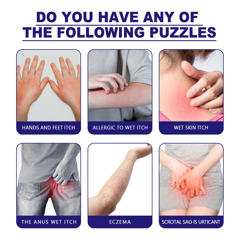 Psoriasis Antibacterial Cream Dermatitis Eczematoid Ointment Effective ...