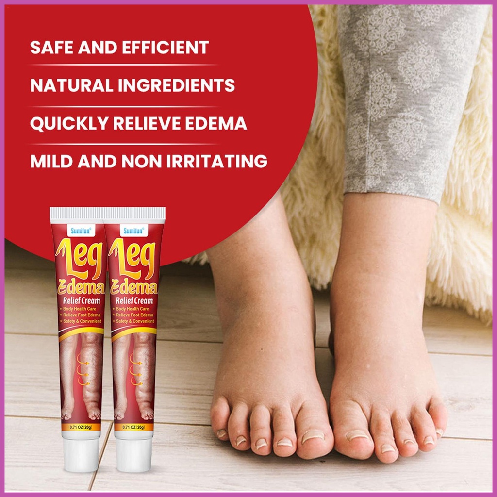 Leg Swelling Cream Gel For Soothing Relief Leg Syndrome Relief Relaxing ...