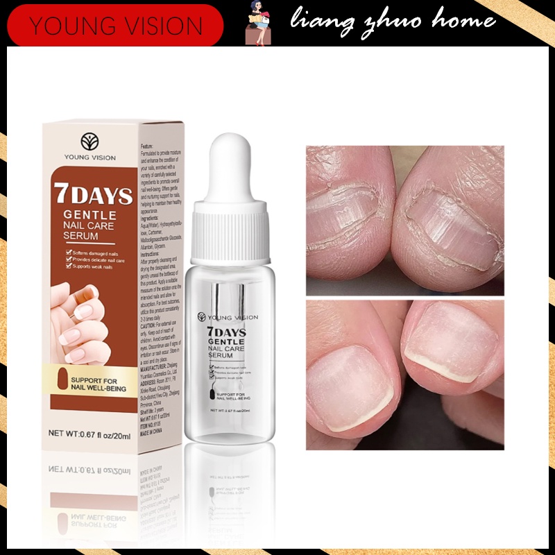 YOUNG VISION Toenailcare Removal Paronychia Oil Ingrown Toenail ...