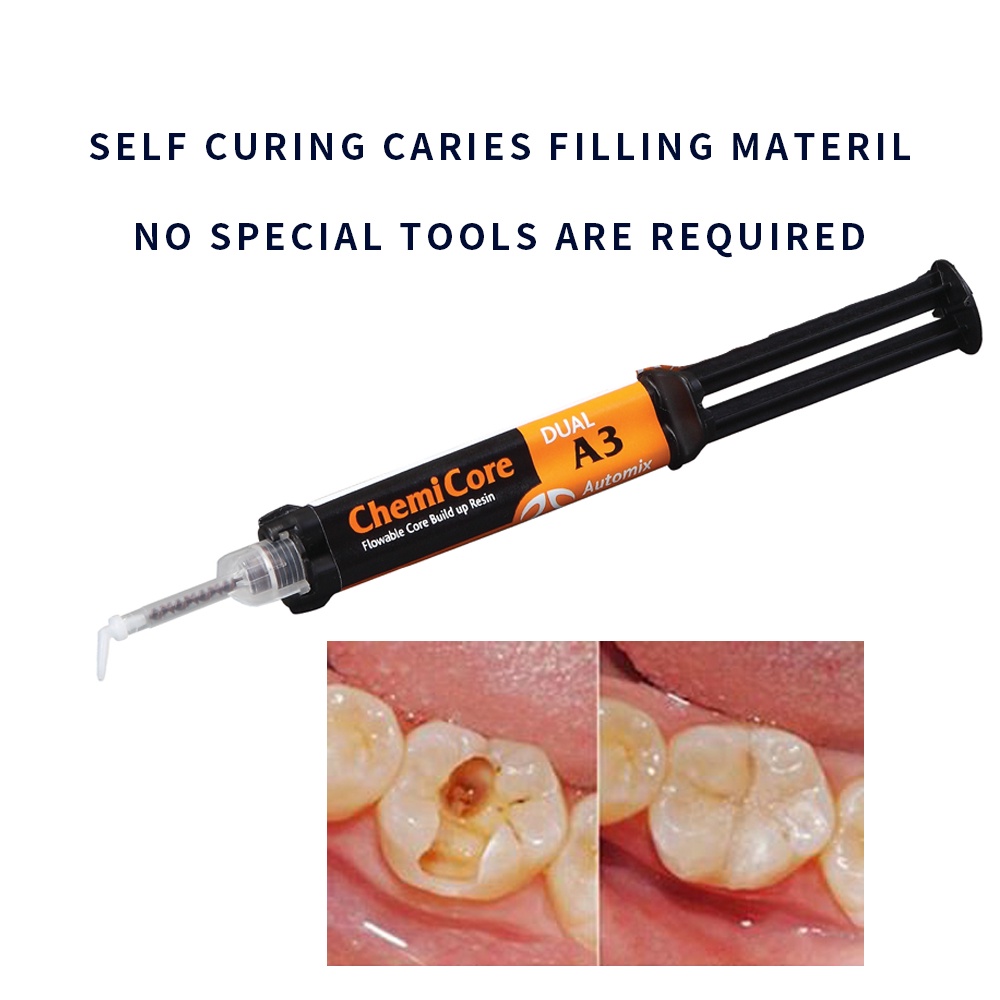 HoubIIPB1 In Stock Caries Filling Material Tooth Repair Kit Self Cure ...
