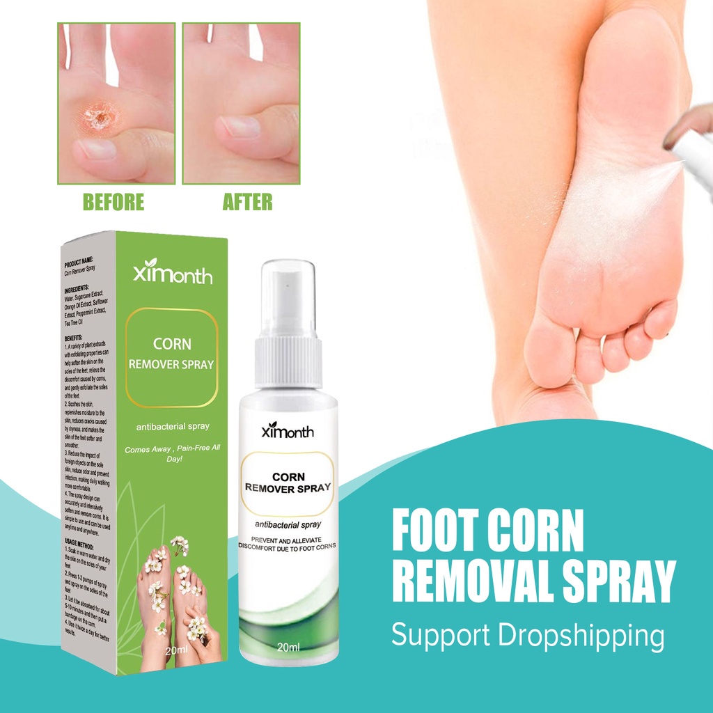 Corn Remover Spray Foot Corn Removal Spray Treatment Calluses Plantar ...