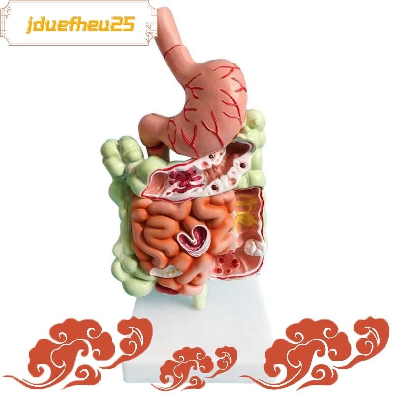 Human Digestive System Model Stomach Anatomy Large Intestine Cecum ...