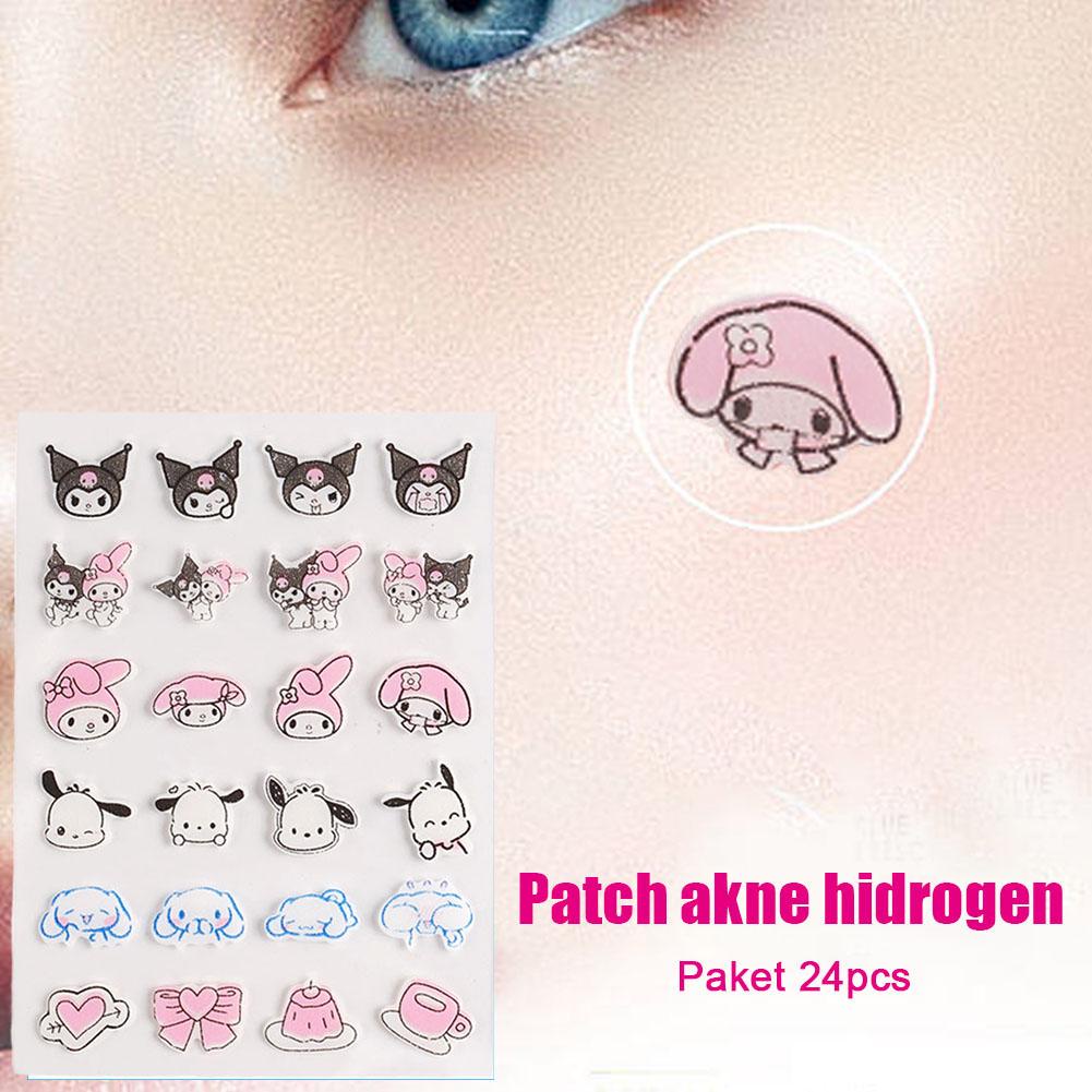 24pcs/sheet Cartoon Cute Kulomi Pacha Dog Acne Patch Hydrocolloid Acne ...