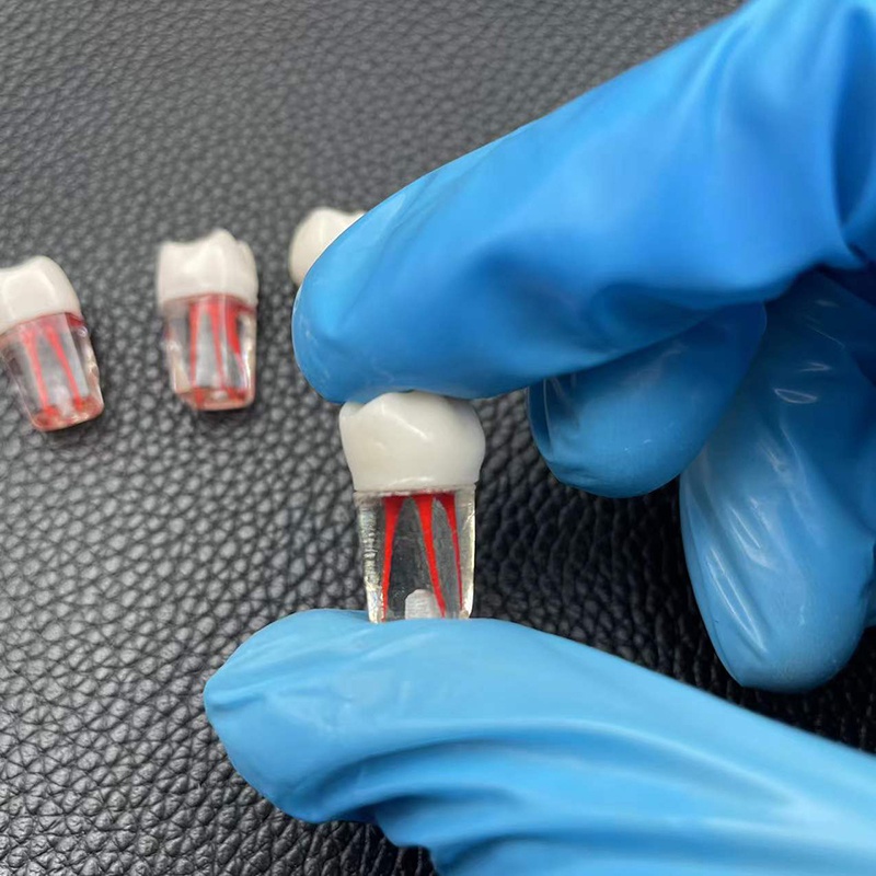 Dental Endo Training Block Tooth Endodontics Root Canal Model RCT ...