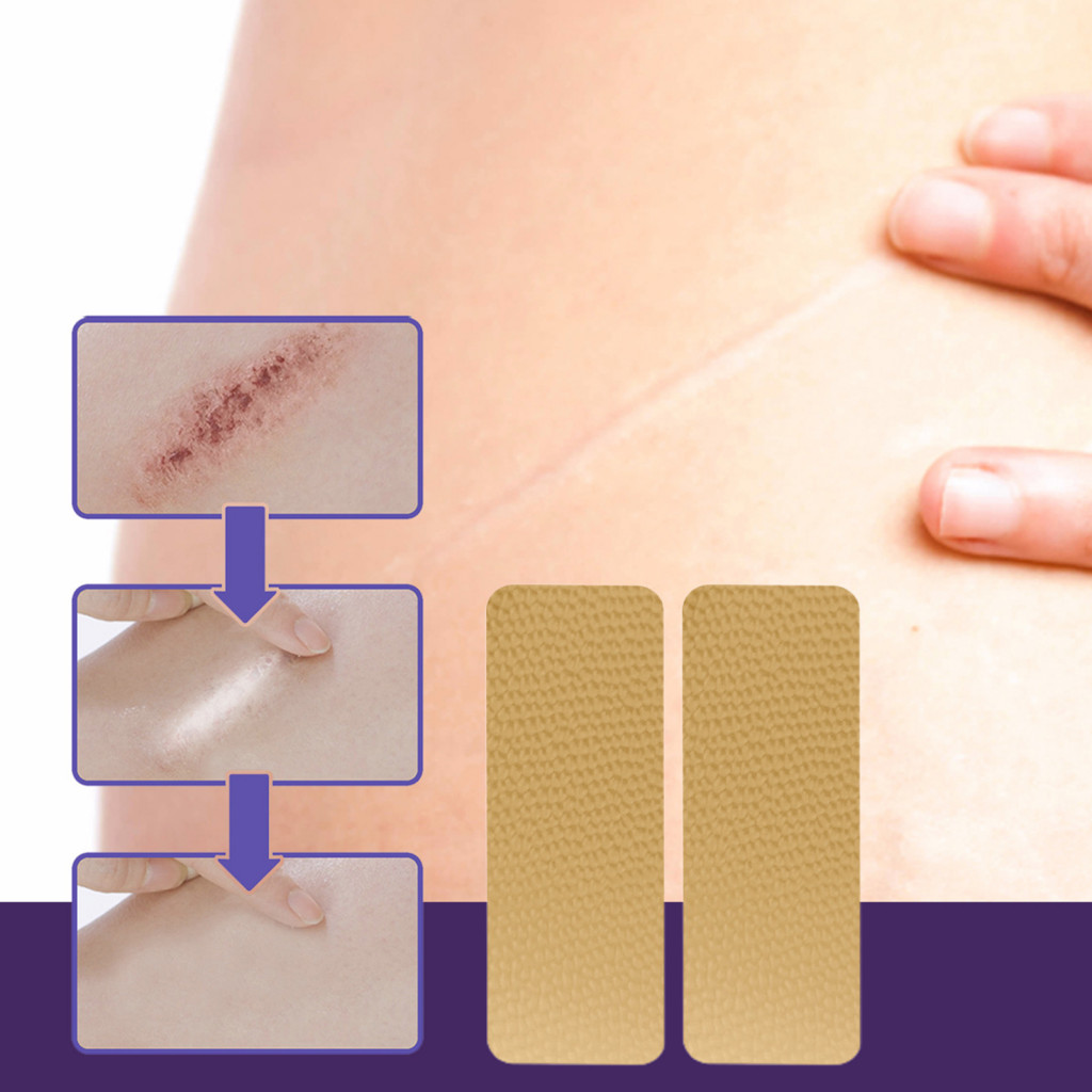 8Pcs/Box 22g Scar Repair Patch Waterproof Effective Flexible Long ...