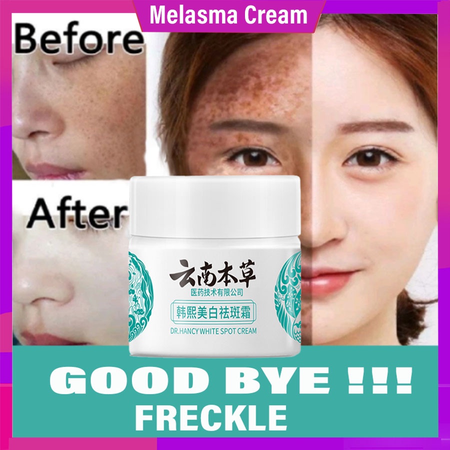 Face Whitening Cream Yunnan Herbal Whitening Freckle Cream Moisturizing ...