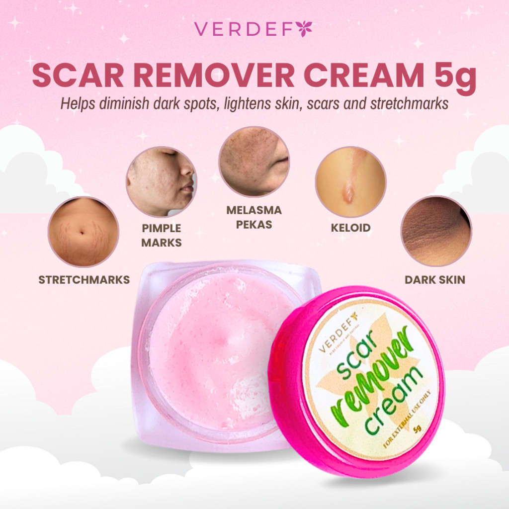 Keloid & Stretch Mark Remover Cream Scar Remover Cream MIRACLE CREAM ...