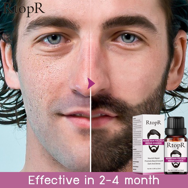 RtopR Hair Follicle Repair Essence Men Styling Moustache Hair Growth Of ...