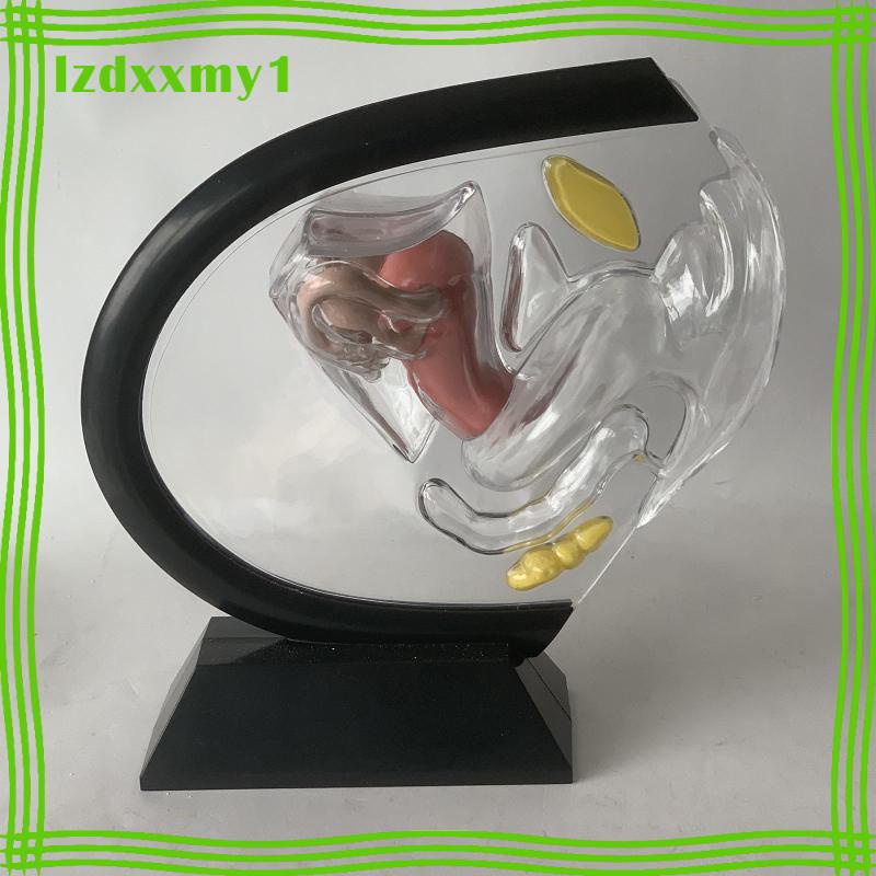 [ Science Reproductive Uterus Model Transparent Ovarian Structure ...