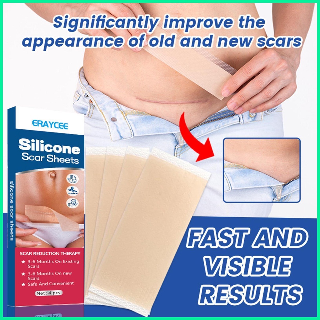 Silicone Scar Tape Effective 4 Pack Silicone Gel Sheets for Scars Scar ...