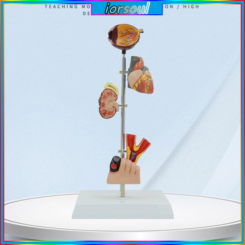 IOR Anatomical Pathological Kidney Model for Diseases Study Medical ...