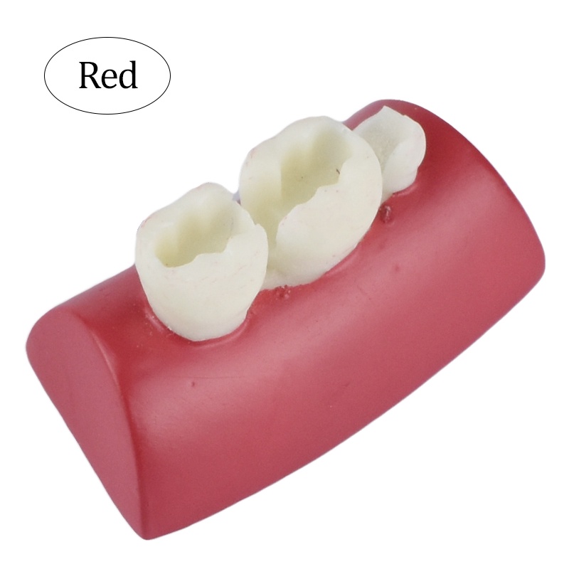 Teeth Model Dental Resin Block Filling Exercise Model Inlay Practice ...