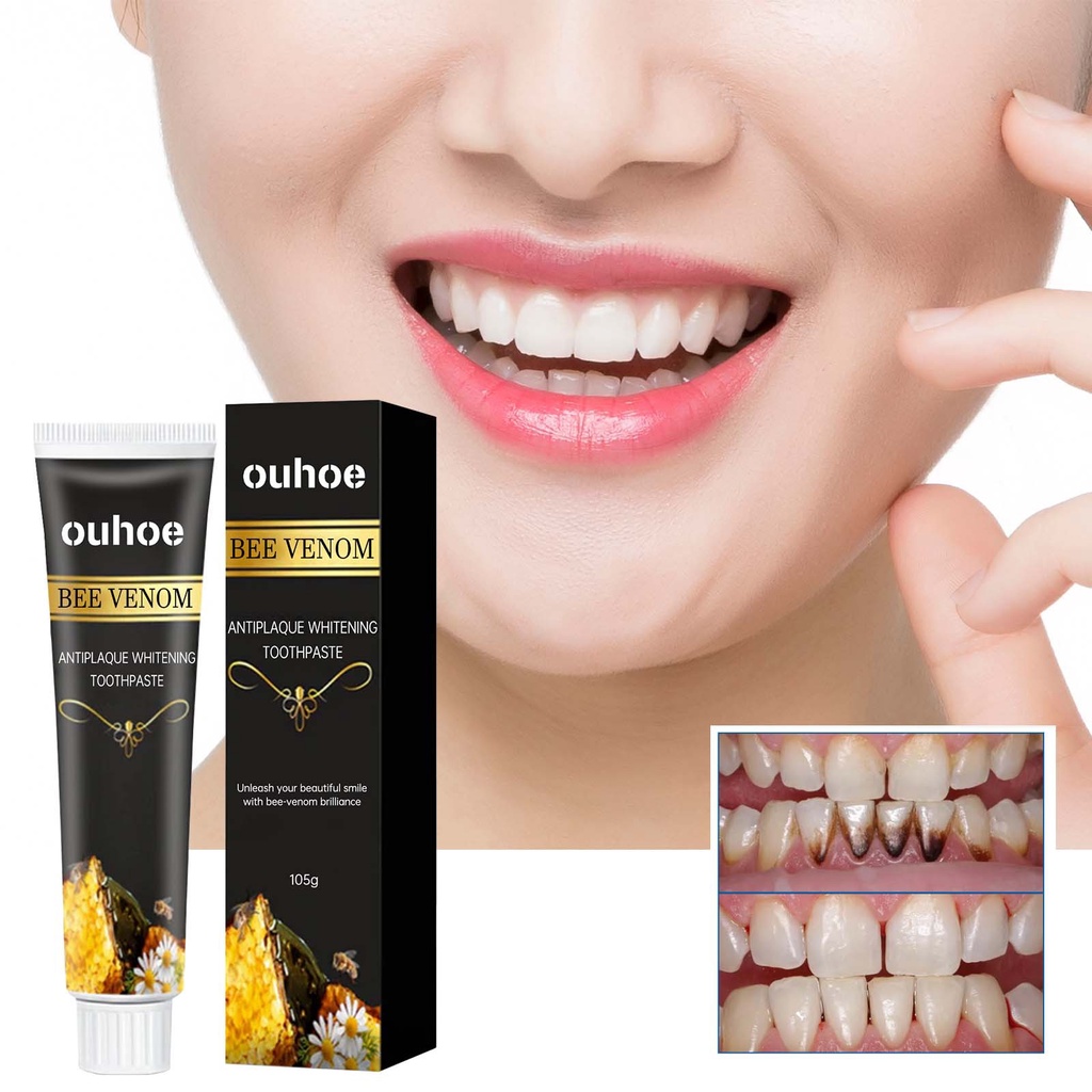 OUHOE Bee Venom Antiplaque Whitening Toothpaste Remove Dental Stain ...