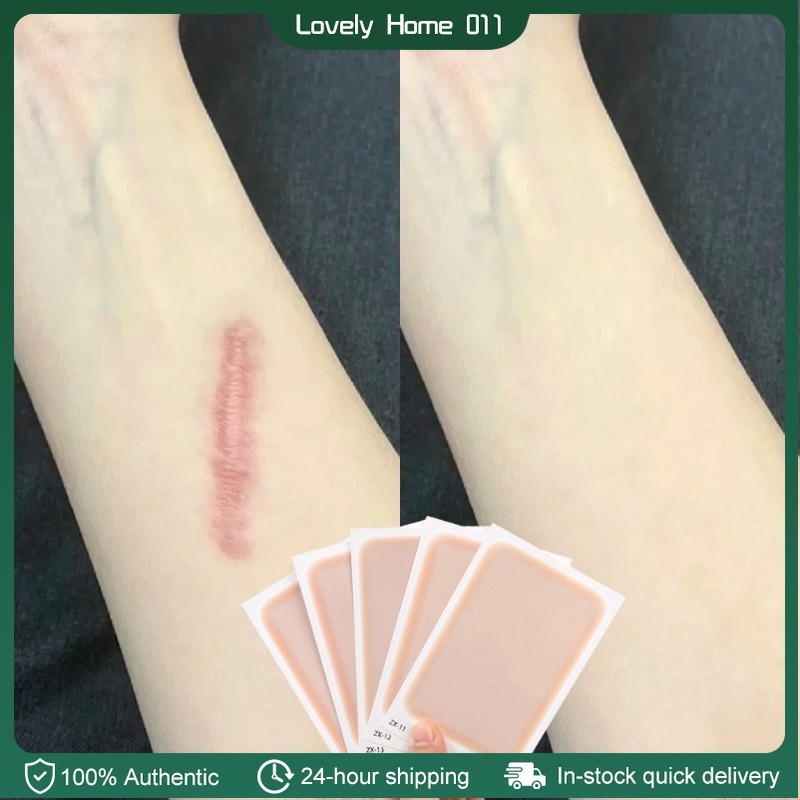 4PCS Tattoo Cover Up Patch - Temporary Corrective Tattoos Stickers -for ...