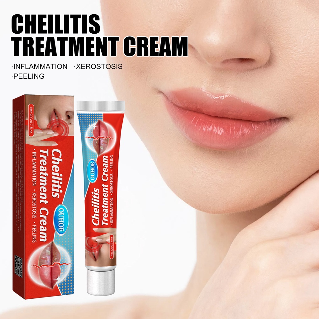 OUHOE Cheilitis Treatment Cream Lip Repair Cream 20g Repairs Dry Flaky ...