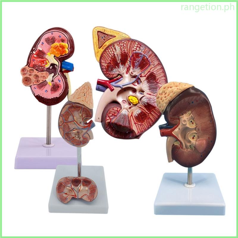 Human Kidney Anatomical Model Static Anatomy Organ 3-D Kidney Organ Model Medical School ...