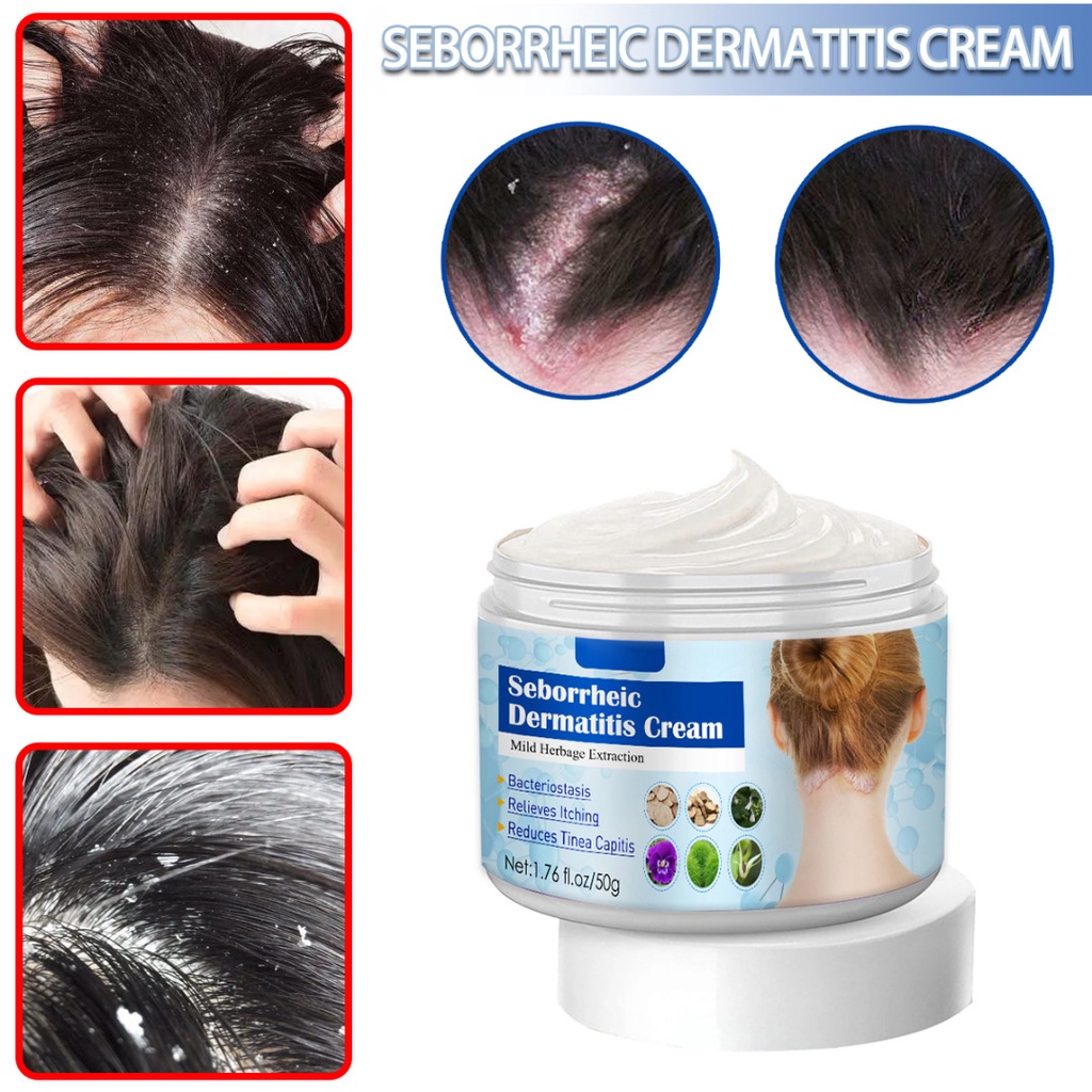 Moon Lipid Overflowing Skin Cream Head Acne Itching Scalp Skin Problem ...