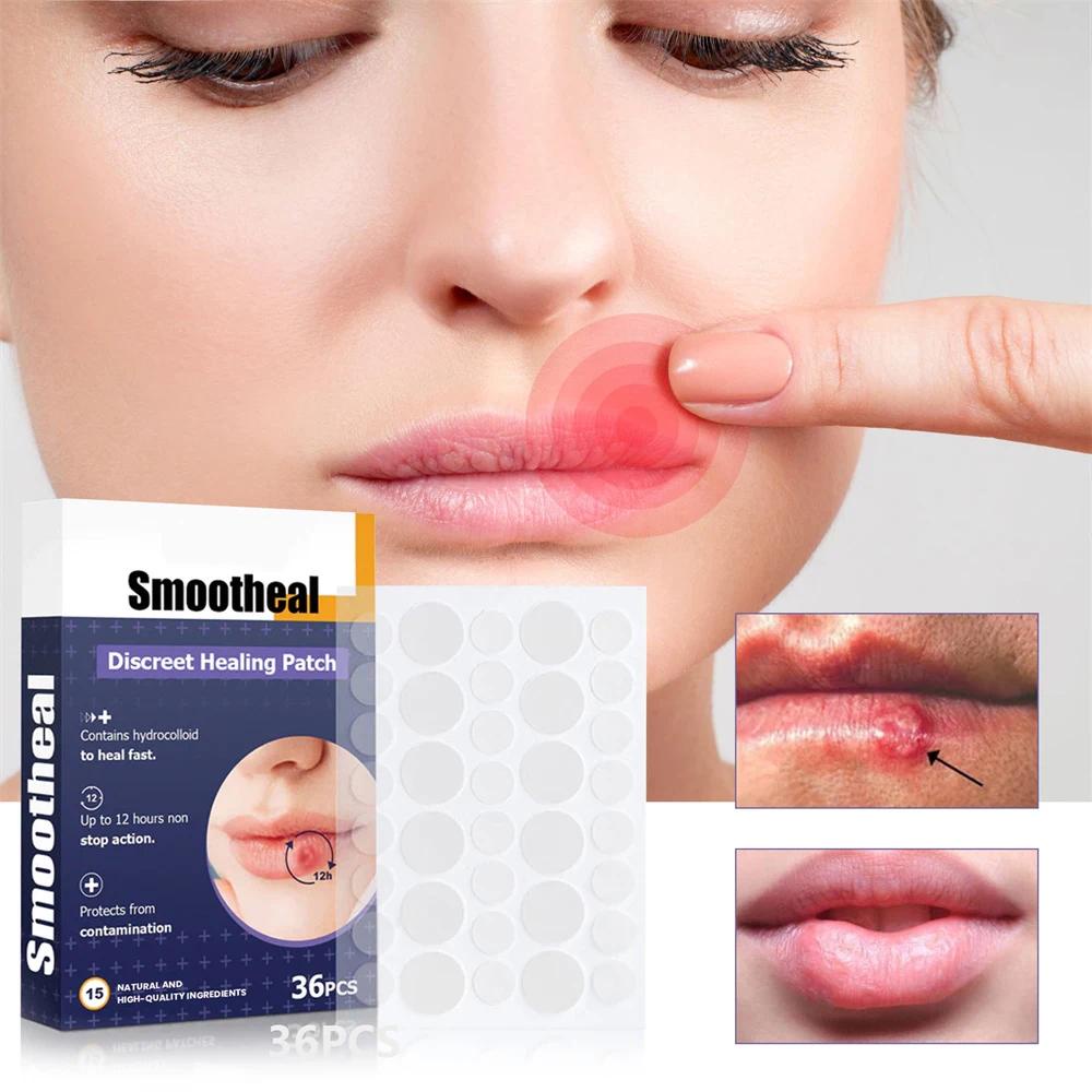 Repair Lips Lip Care Herpes Paste Care Patch Antibacterial And Anti ...