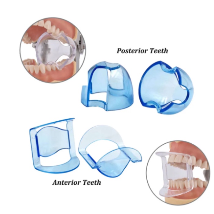 Anterior/Posterior Mouth Opener Dental Lip Cheek Retractor Expander ...