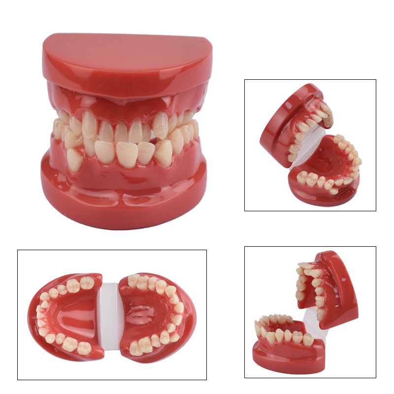 Dental Model 3D Demostration Teaching Model Teeth Model Resin Tooth ...