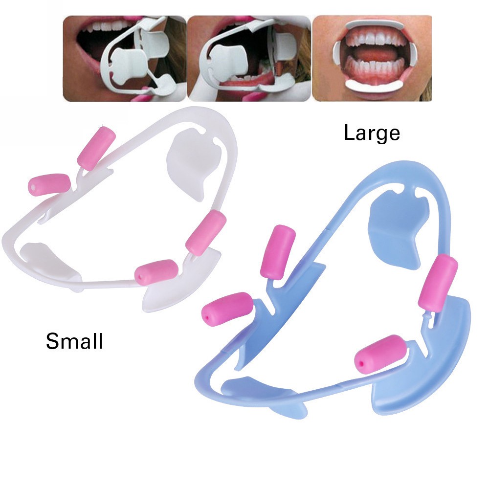3D Mouth Opener Dental Cheek Lip Retractor Dental Tool | Shopee Philippines