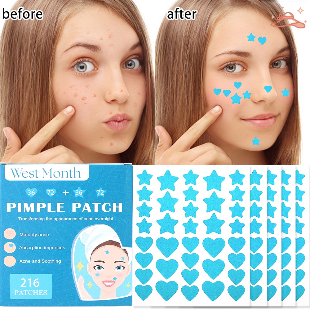 Waterproof Colorful Star Acne Pimple Cover Patch/ Self-adhesive ...