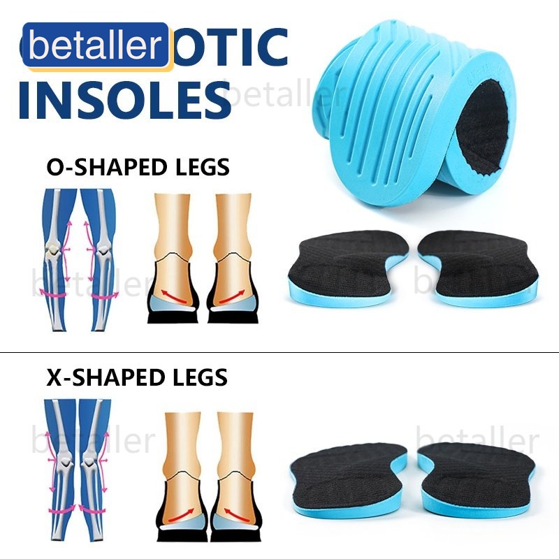 Leg Shape Corrector Arch Support Insole O Leg X leg Flat Foot Orthotics ...