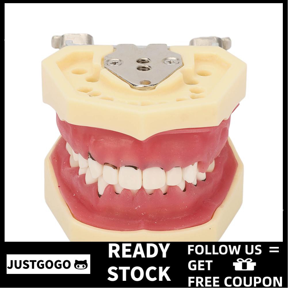 Justgogo Periodontal Disease Model Demonstration Educational Resin for ...