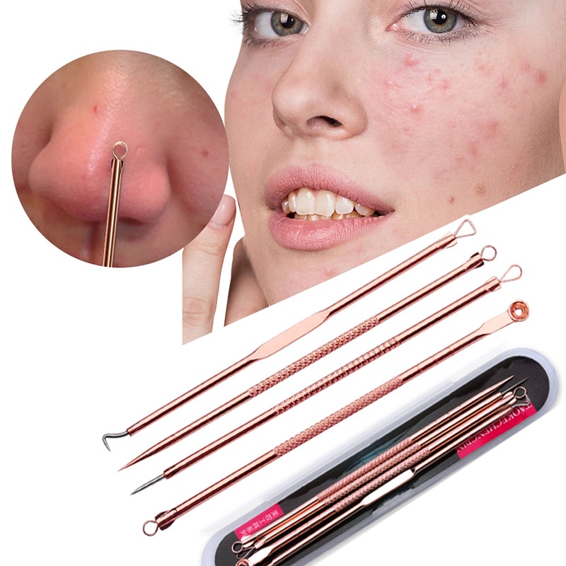 5-in-1 Acne and Blackhead Extraction Kit | Shopee Philippines