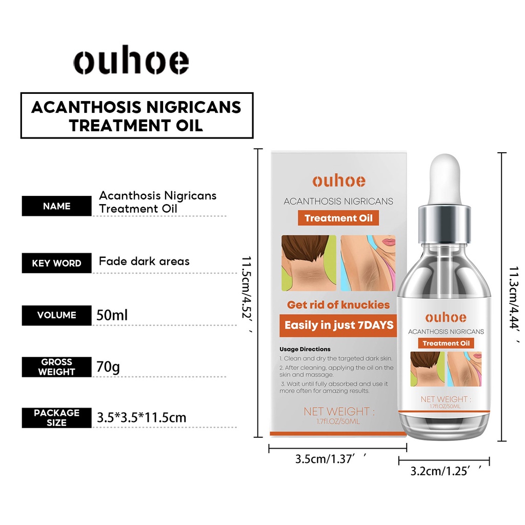 OUHOE Acanthosis Nigricans Treatment Oil Dark Knuckle Whitening Serum ...