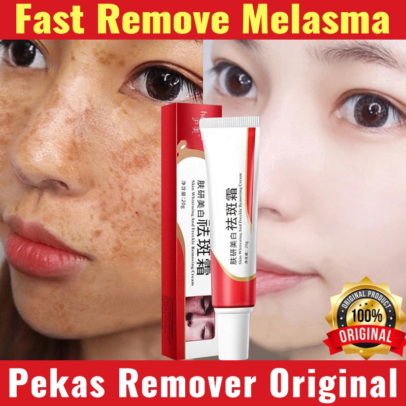 Melasma Cream Pekas Remover Original Collagen Pekas & Freckles Remover ...