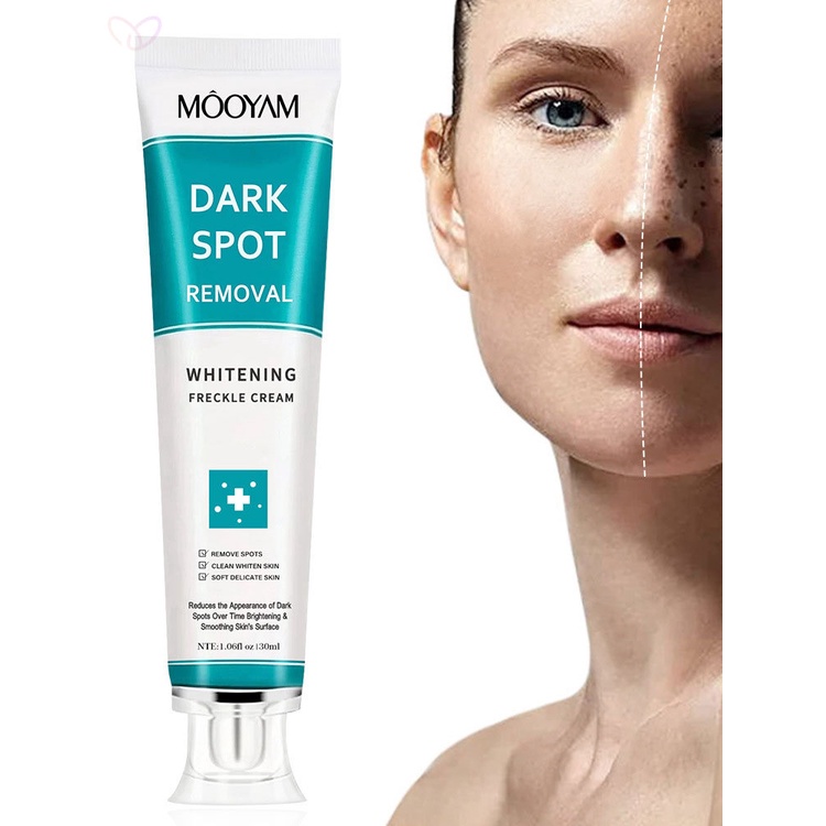 YET Effective Dark Spot Remover Cream for Age, Sun and Black Spots ...