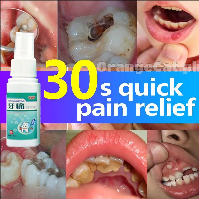 Toothache Pain Reliever spray gamot sa sakit ng ngipin 35ml toothache ...
