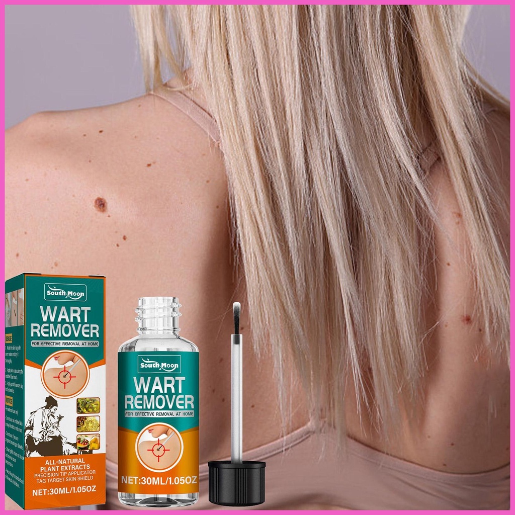 Skin Wart Remover Liquid Against Moles and Genitals Fast Wart Removal ...