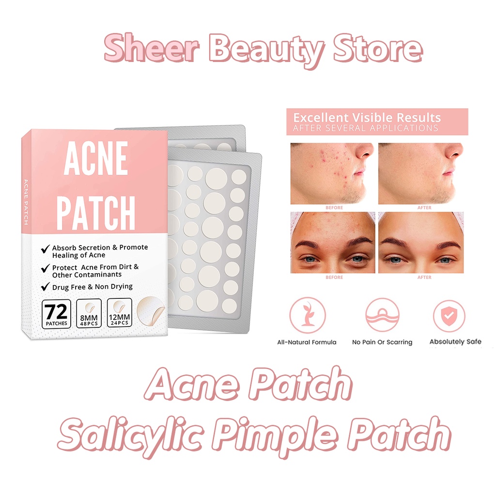 72 PCS Salicylic Acne Pimple Patch Acne Treatment Skin Care Acne Repair ...