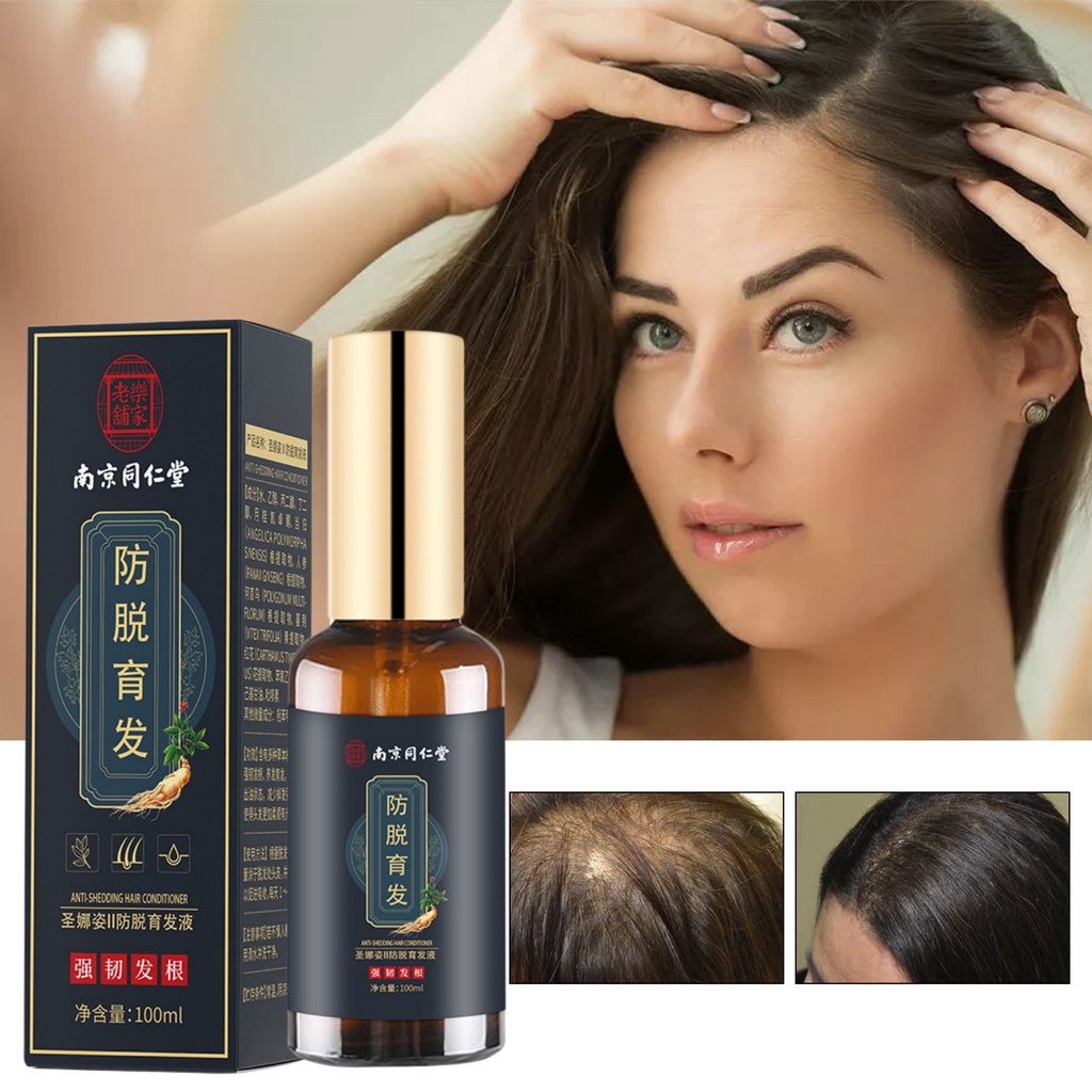 Anti Hair Loss Hair Growth Essential Anti Hair Loss Essence Fast Grow
