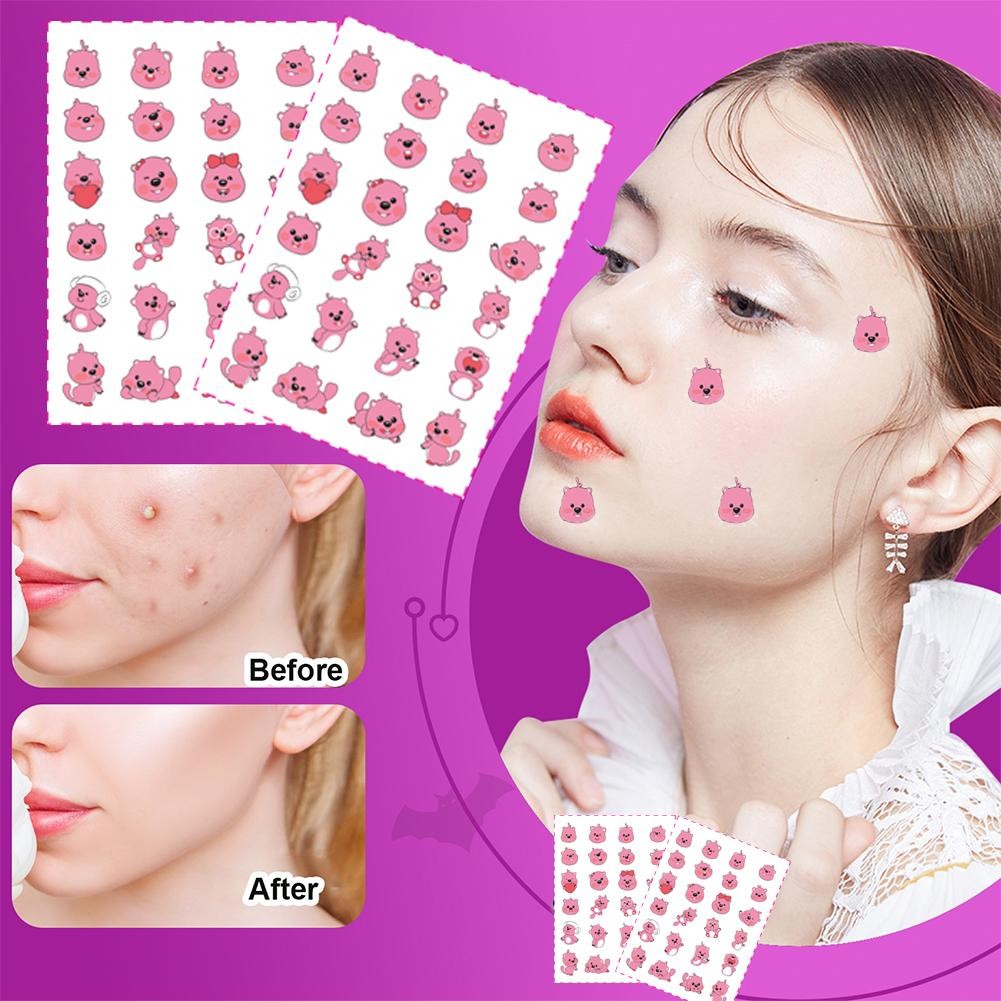 24pcs/sheet Cute Loopy Acne Care Hydrocolloid Pink Pimples Patch Acne ...