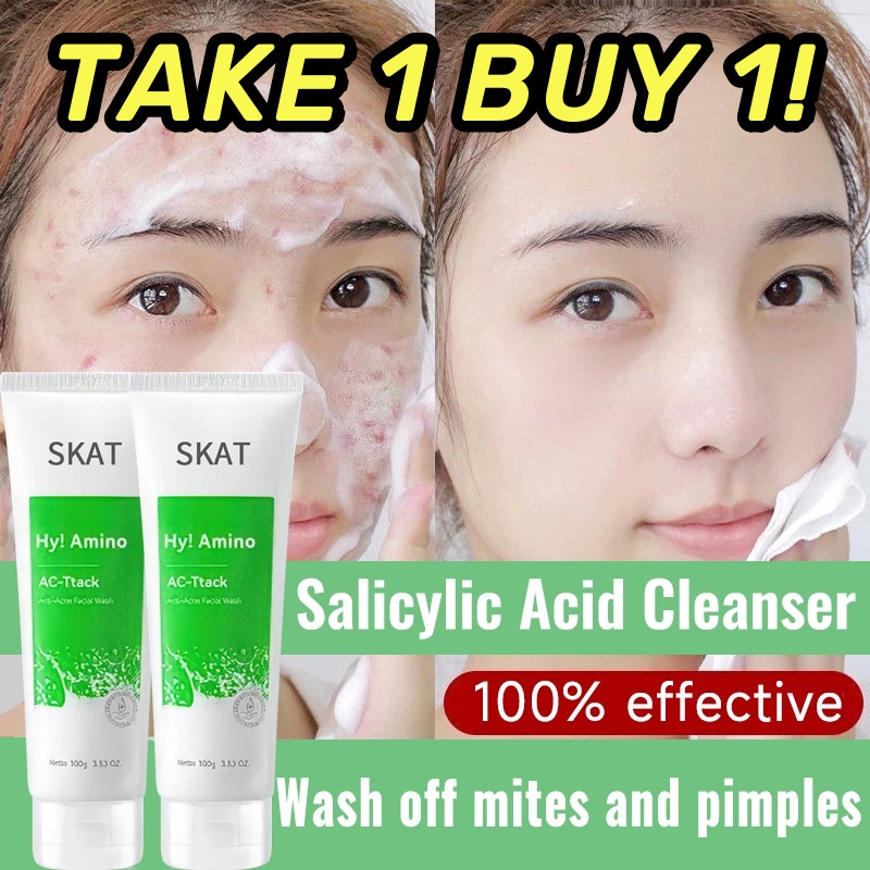 Amino Acid Facial Cleanser Salmonic Sour Facial Cleanser Oil Control ...