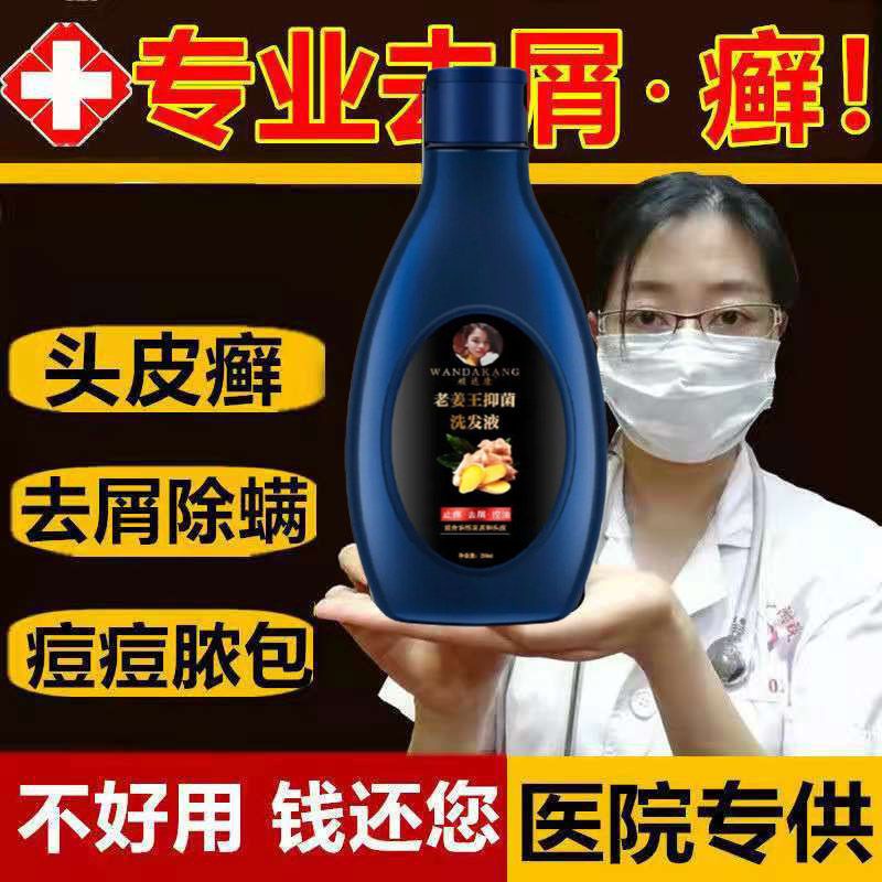 Scalp Folliculitis Fat Overflow Dermatititis Shampoo Remove Pimples