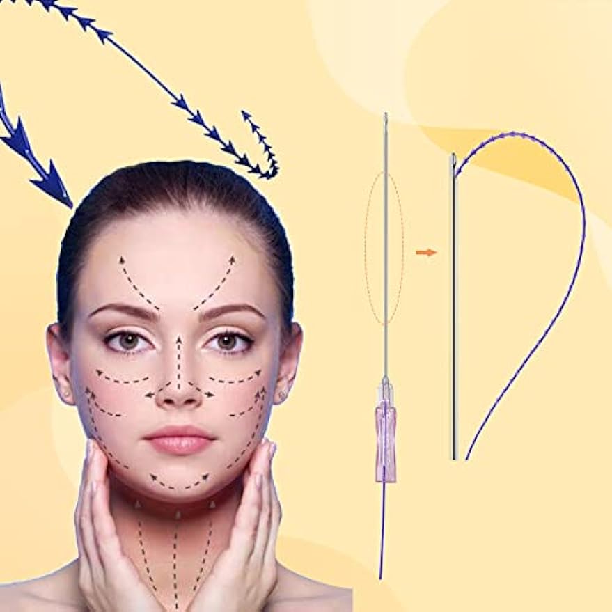 20pcs Pdo/PCL Fishbone Thread18G100MM Age-Defying LiftBullet Model Cog ...