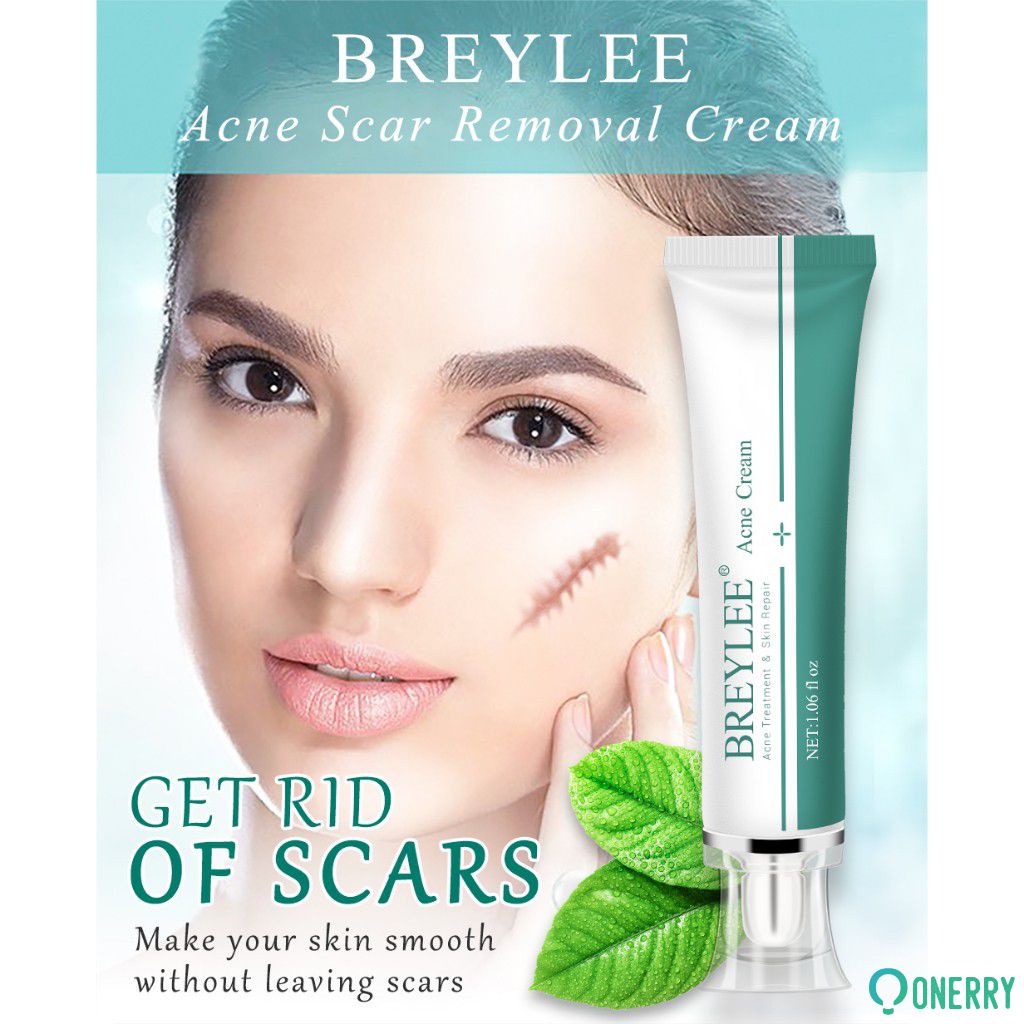 Breylee Scar Removal Gel 30g Skin Repair Scar Acne Treatment Remove Stretch Marks Whitening ...