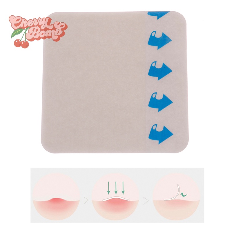 (Cherry Bomb) Hydrocolloid Adhesive Dressing Wound Dressing Sterile ...