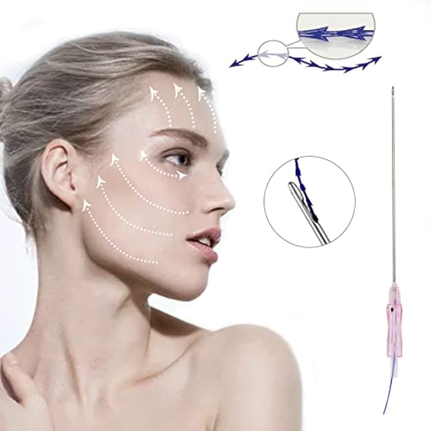 Minerva PdoPcl Cog Threads Fishbone Threads 18G100mm W-Type Blunt ...