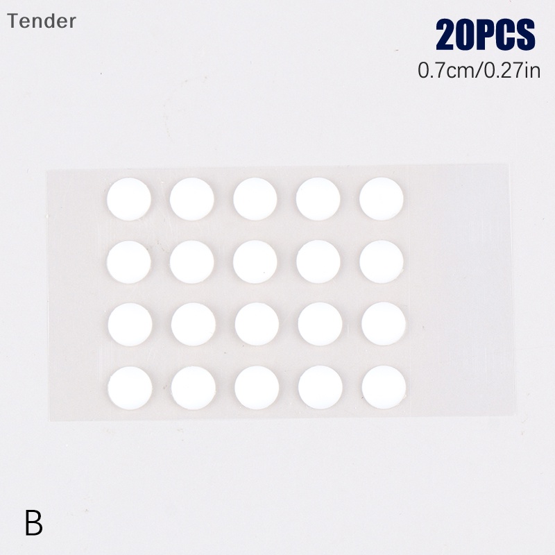 [Shyvana] Ultraglide Small Round Dot PTFE Mouse Skates DIY Mice Glide ...