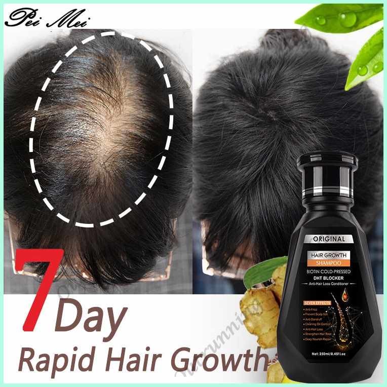 PEIMEI:A=ginger_uH{shampooql-hairBs-growerHo-hairg-growthX-horseV ...